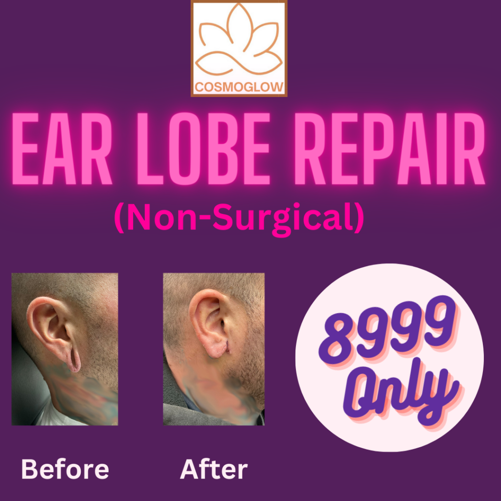 Ear Lobe Repair – COSMOGLOW Skincare & Wellness